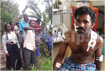 Leopard attack sends 5 to hospital - Video & Photos - Leopard Attack ...